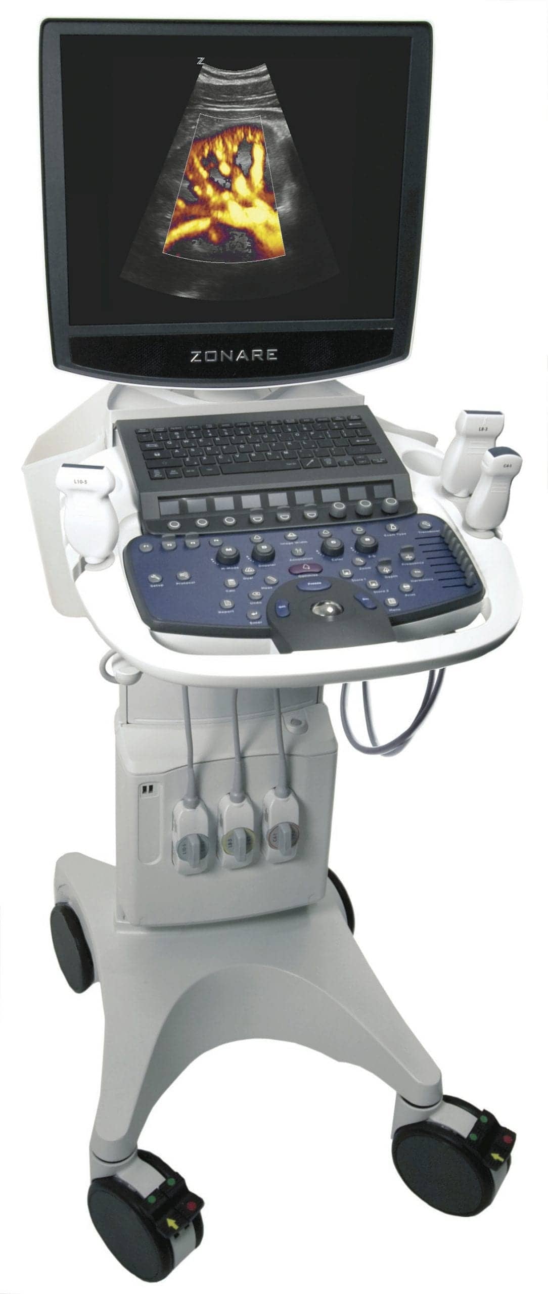 Zonare ZS3 Delivers on Customer Satisfaction - Axis Imaging News