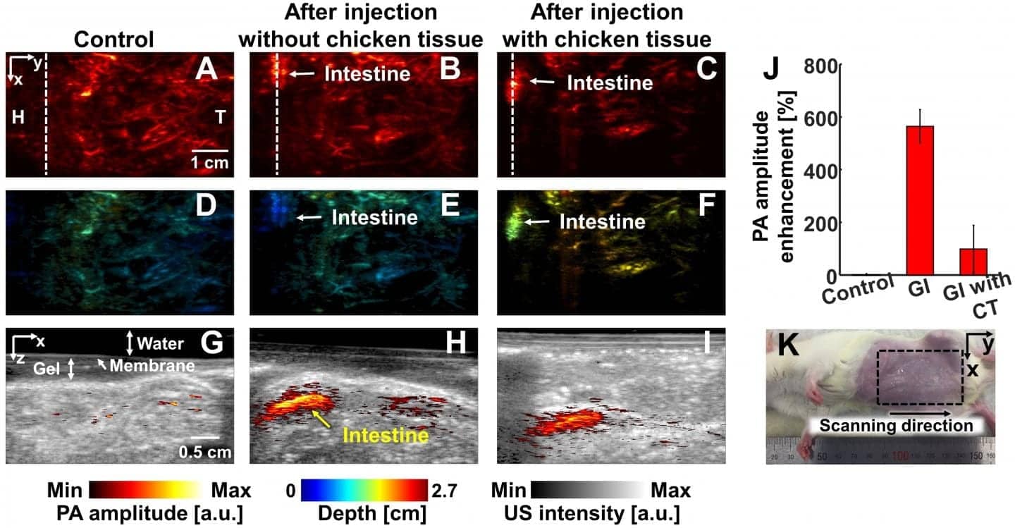 Exploring the deep tissues using photoacoustic imaging - Axis Imaging News