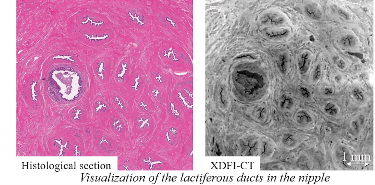 Observing the Internal 3D Structure of the Nipple to Understand and ...