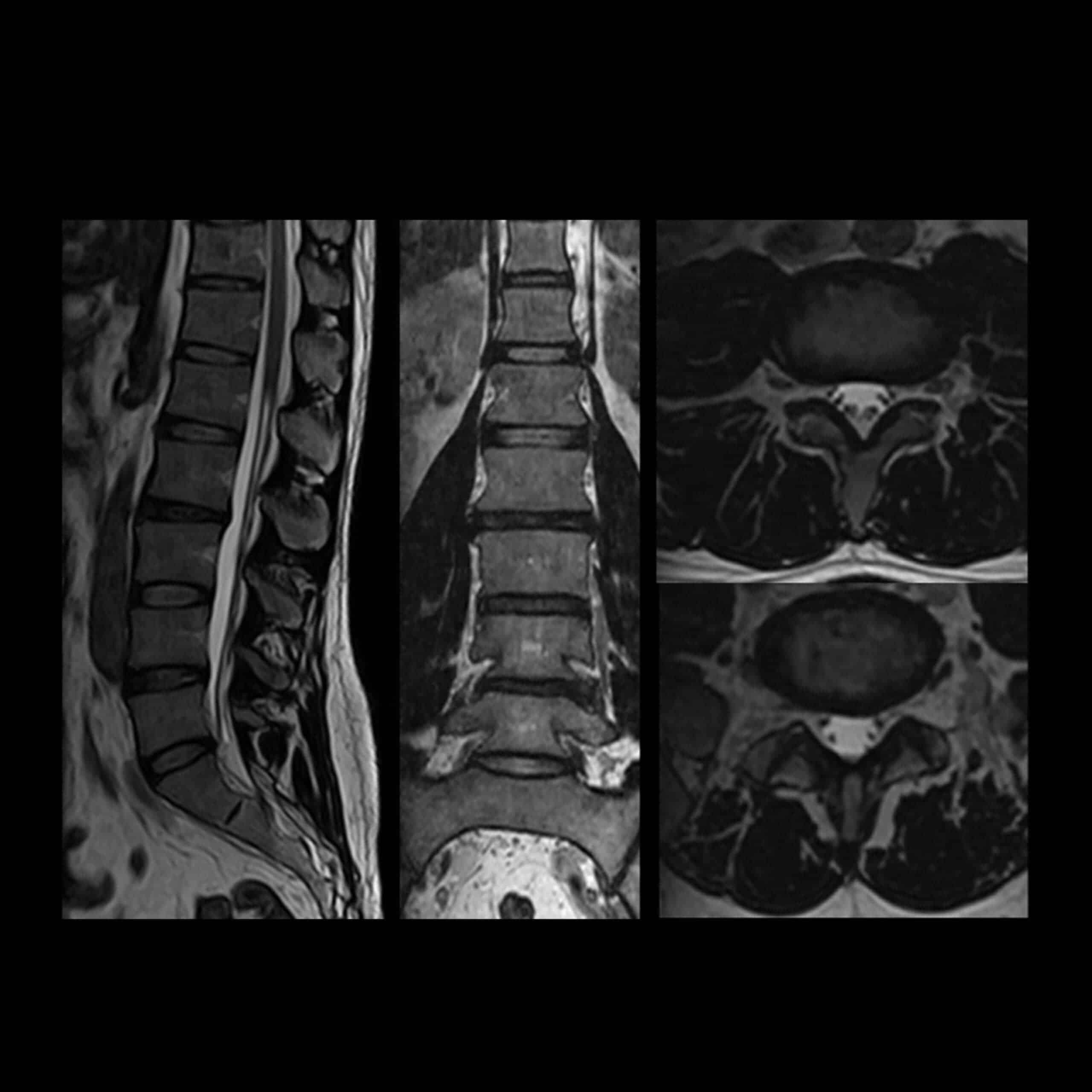 FDA OKs Canon Medical’s Compressed Speeder for 3D Exams on 1.5T MR ...