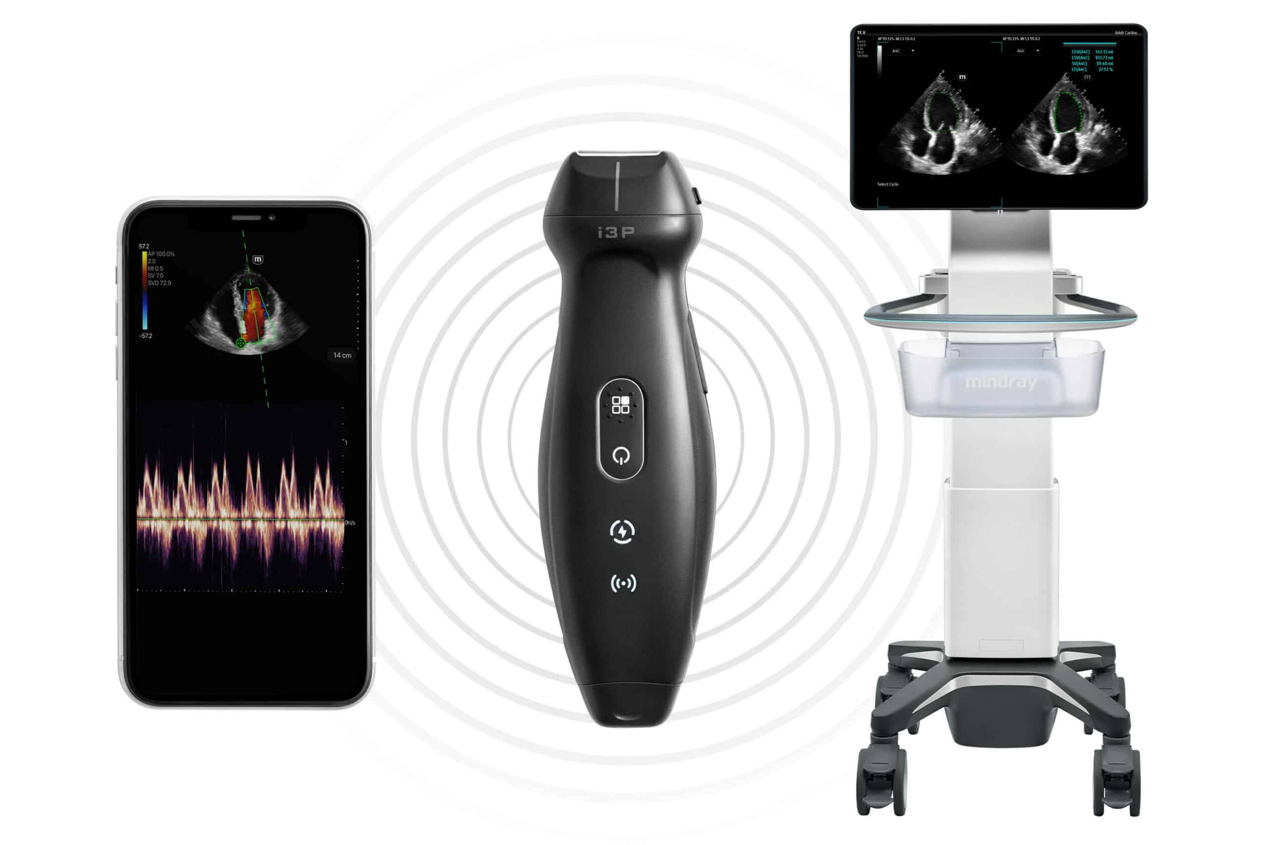 Mindray Launches 2-in-1 Handheld Ultrasound Device - Axis Imaging News