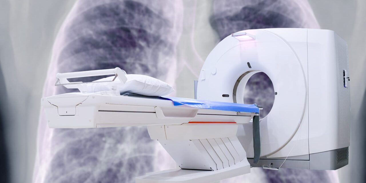 Photon-counting CT Outperforms Conventional CT in Lung Cancer ...
