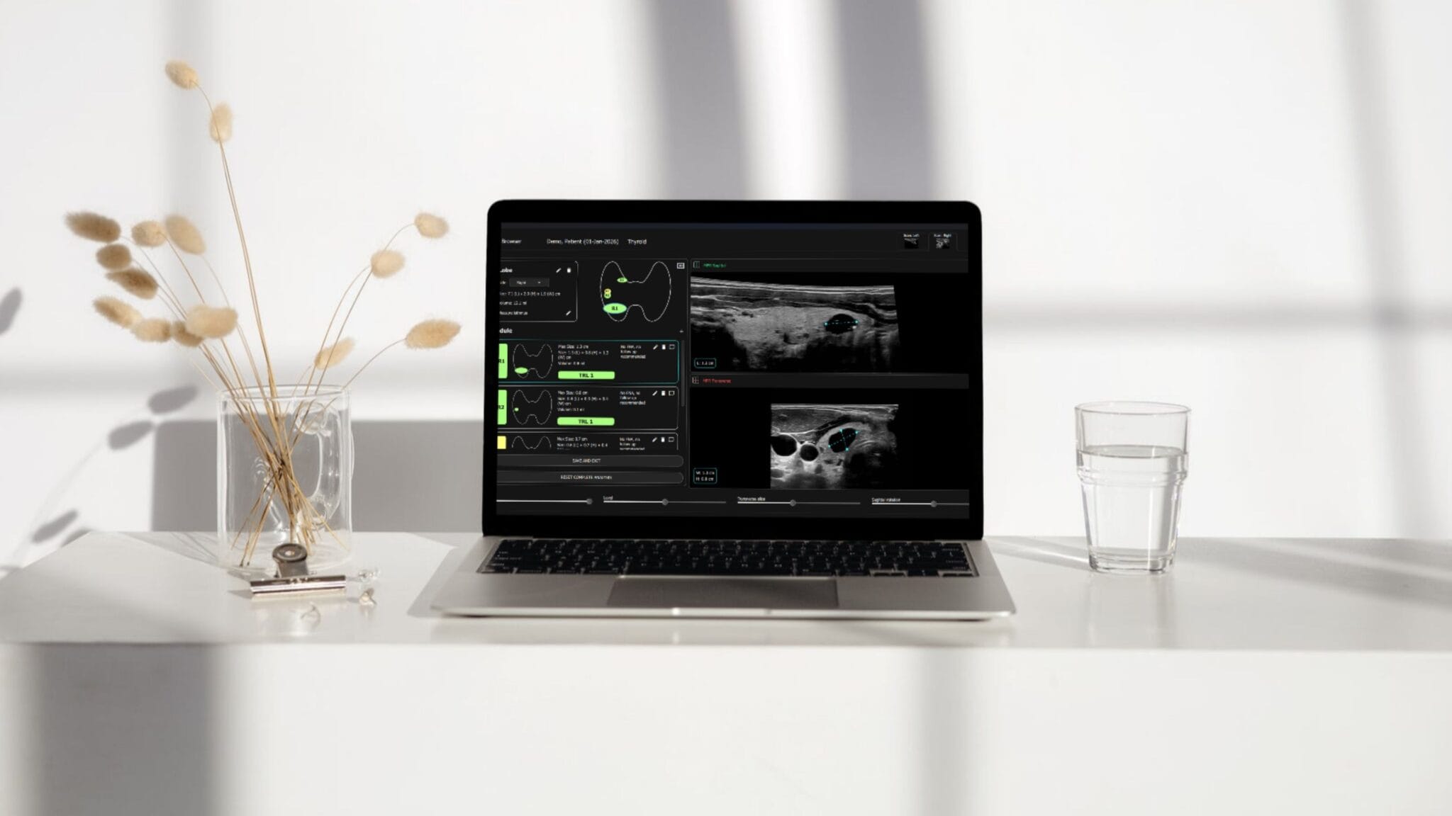 PIUR Imaging Updates AI Thyroid Ultrasound Software to Reduce Workflow ...