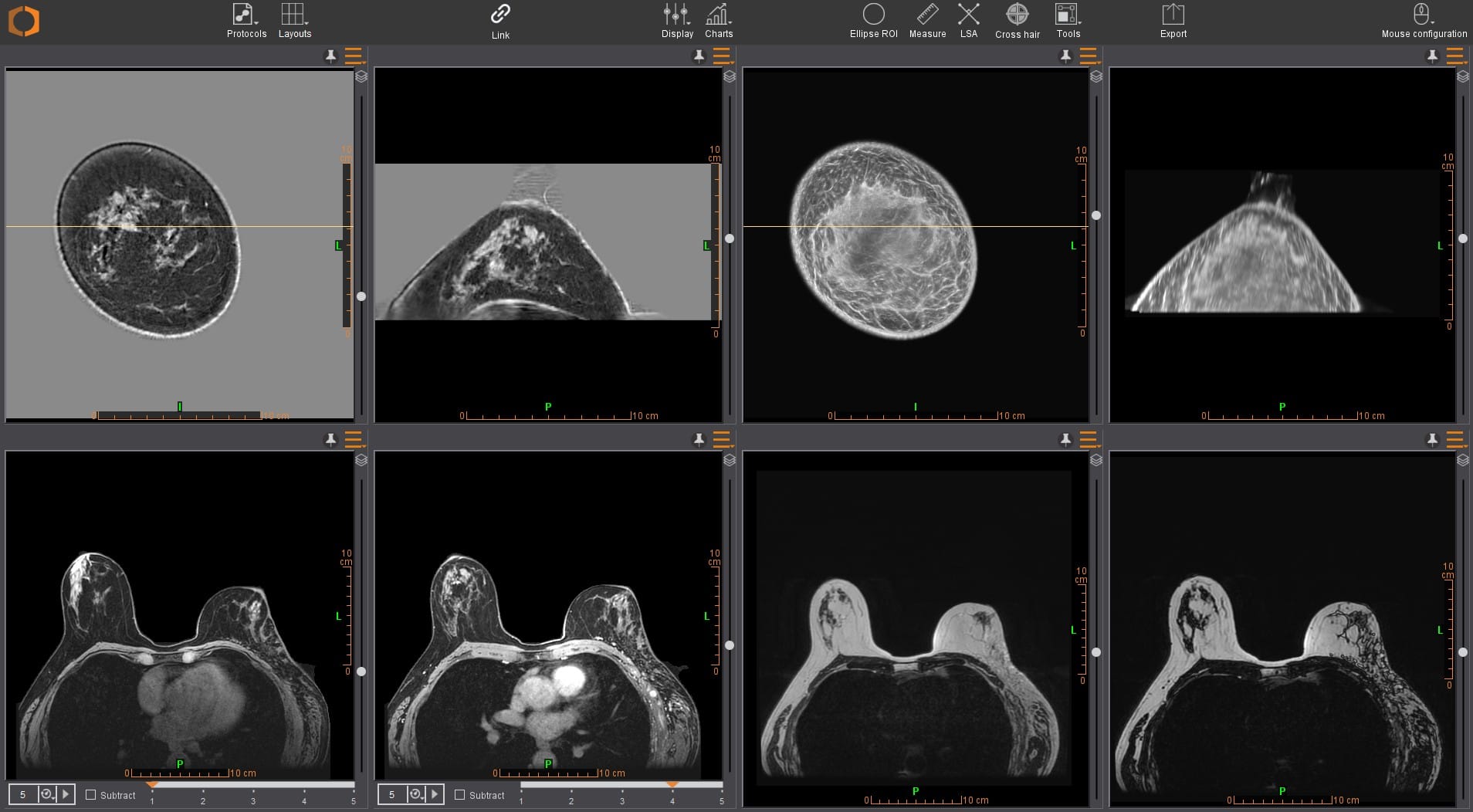 QT Imaging Debuts Unified Viewer for Multimodality Breast Imaging ...