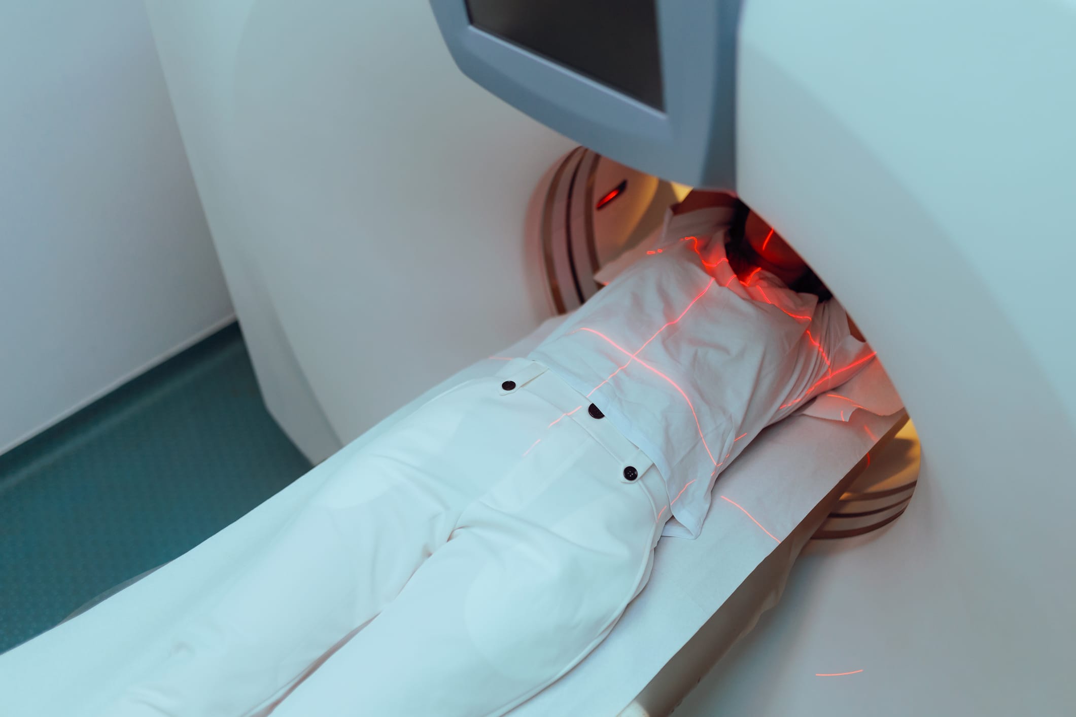 Lung CT Scans May Identify Other Undiagnosed Cancers - Axis Imaging News